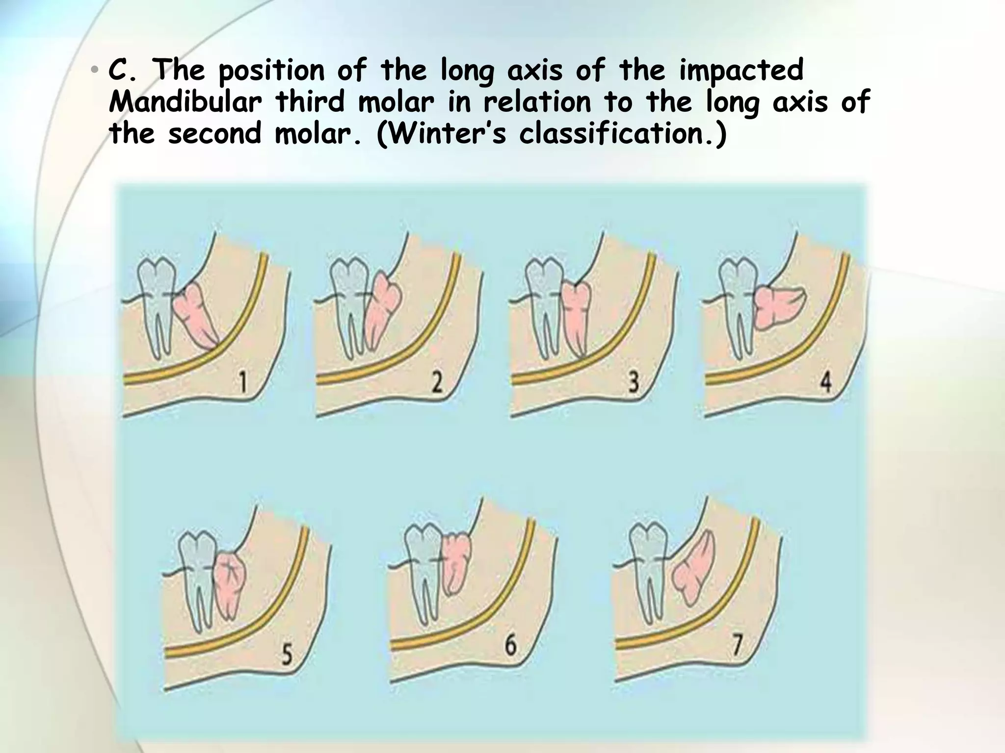 IMPACTION IN ORAL SURGERY | PPTX