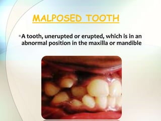 IMPACTION IN ORAL SURGERY | PPTX