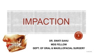 Impaction | PPT