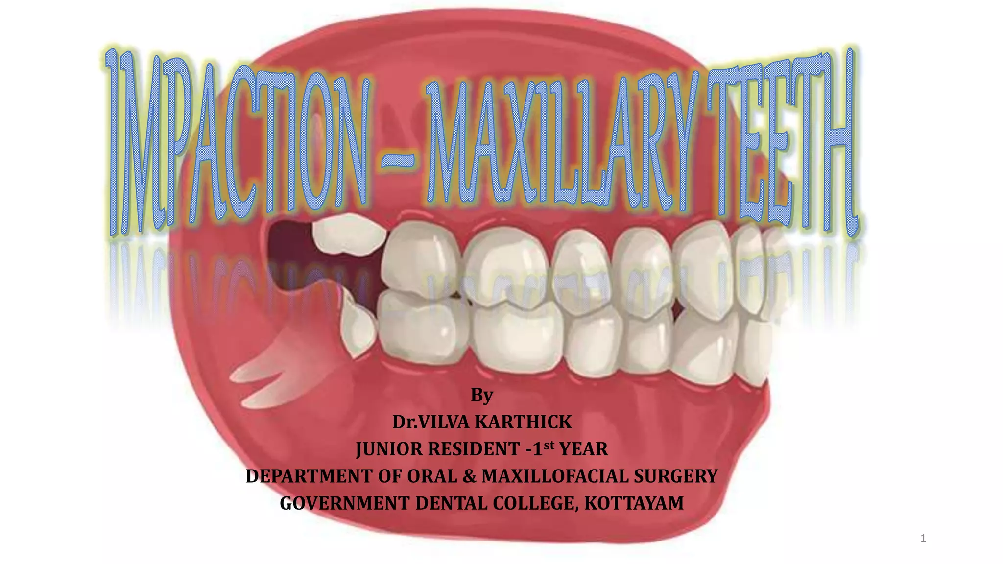 Impaction maxillary teeth part 1 | PPTX