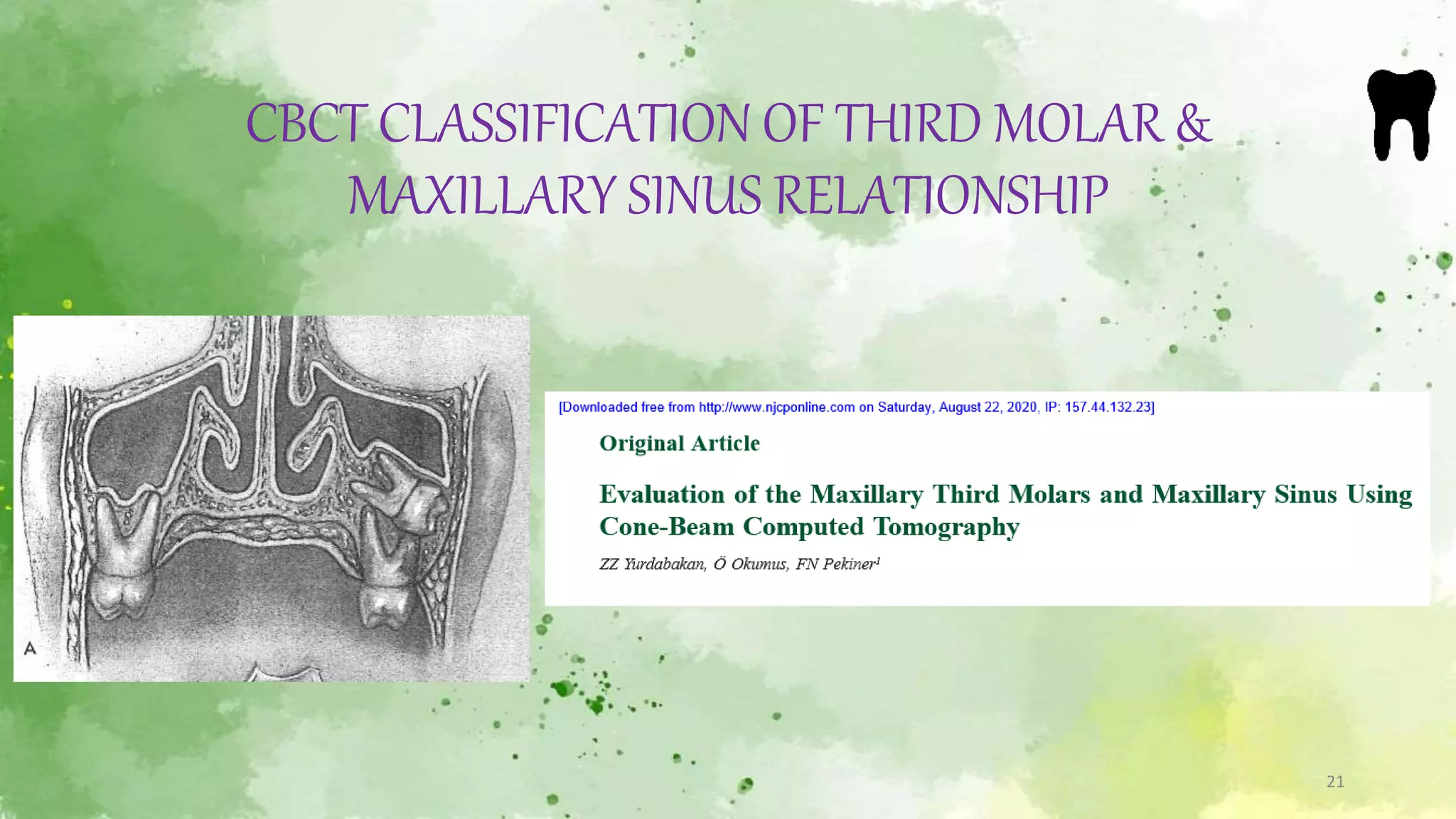 Impaction maxillary teeth part 1 | PPTX