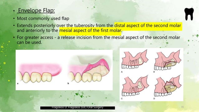 Impaction maxillary teeth part 1 | PPT