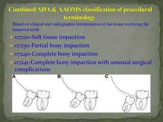 management of impacted teeth | PPT