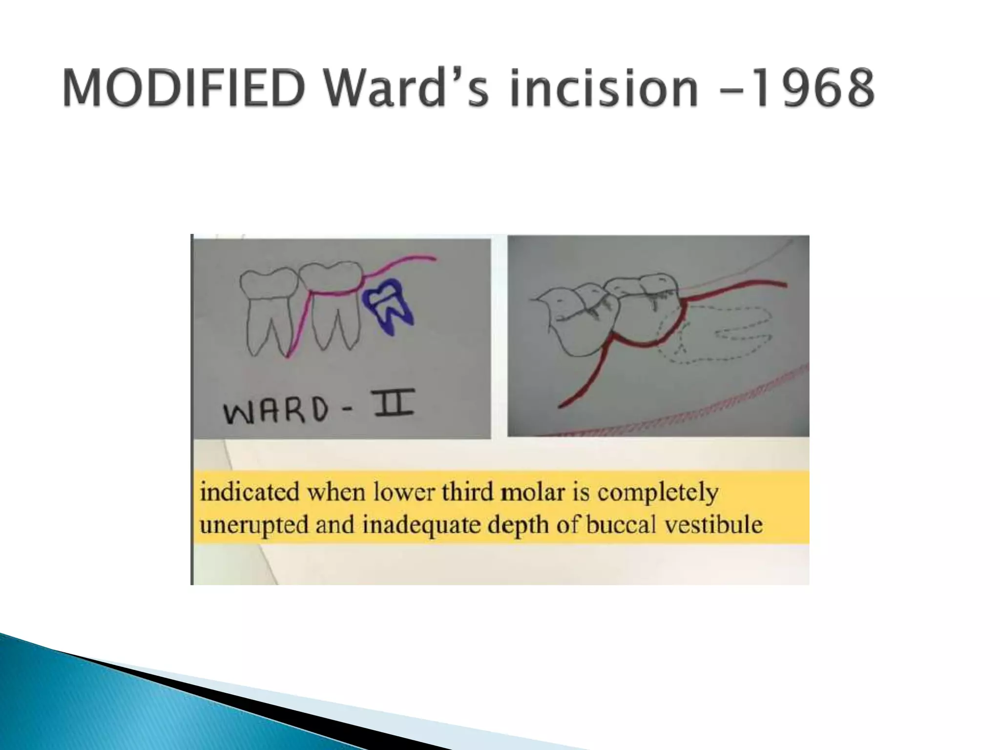 IMPACTION IN ORAL SURGERY UPDATED.pptx
