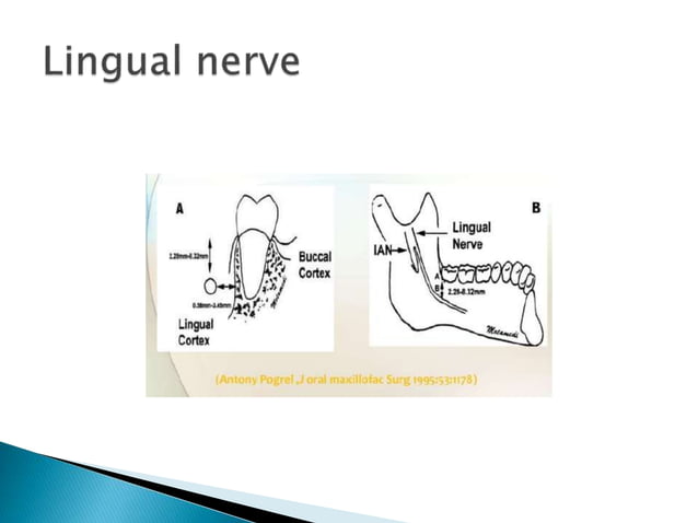 IMPACTION IN ORAL SURGERY UPDATED.pptx