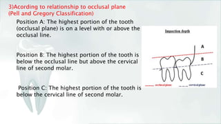 Impaction of mandibular 3rd molar | PPTX