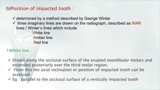 Impaction of mandibular 3rd molar | PPTX