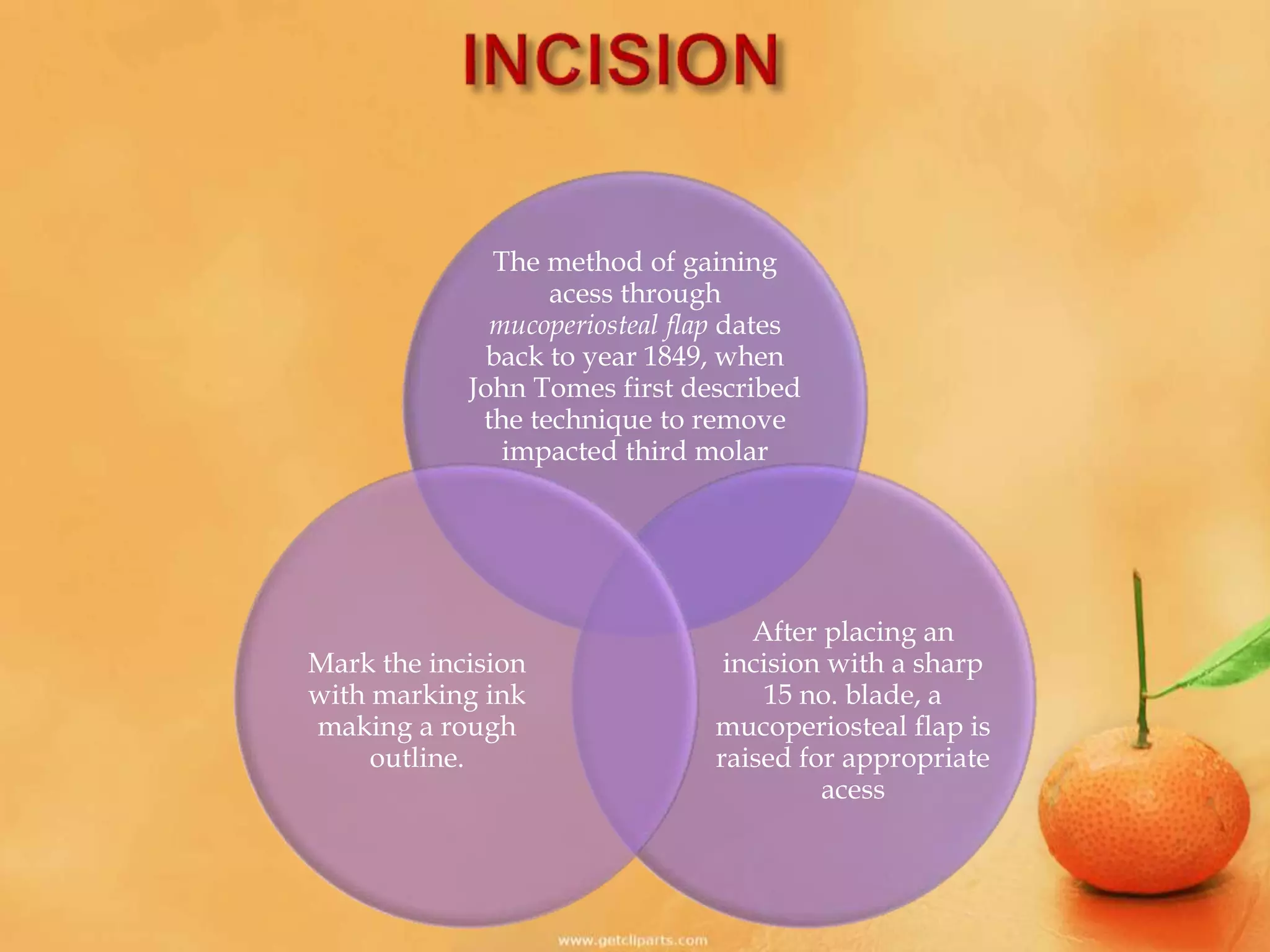 mandibular molar Impactions | PPTX