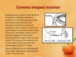 mandibular molar Impactions | PPTX