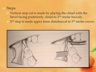 mandibular molar Impactions | PPTX