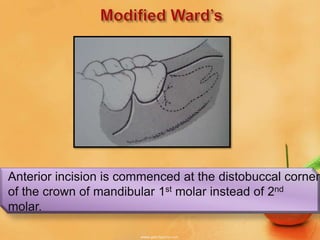 mandibular molar Impactions | PPTX