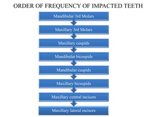 Management of Impacted third molars | PPTX
