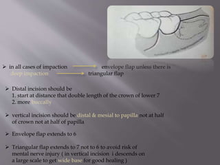 Impaction Tips & Tricks | PPTX