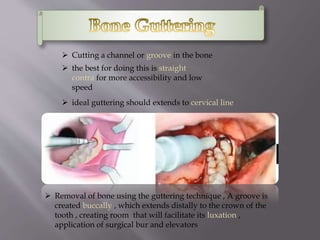 Impaction Tips & Tricks | PPTX