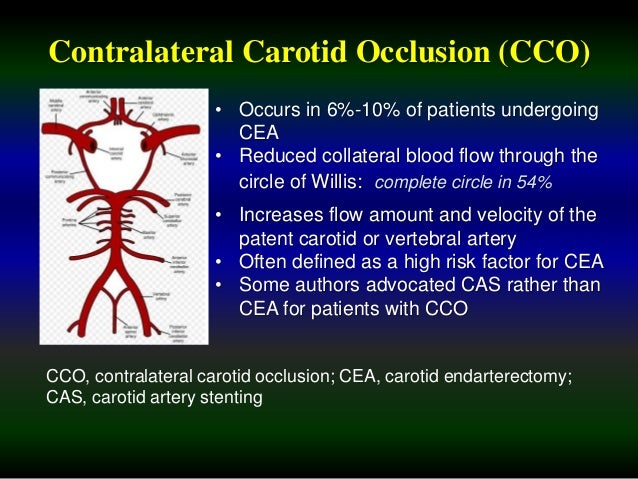 Impact of contralateral carotid or vertebral artery occlusion in pati…