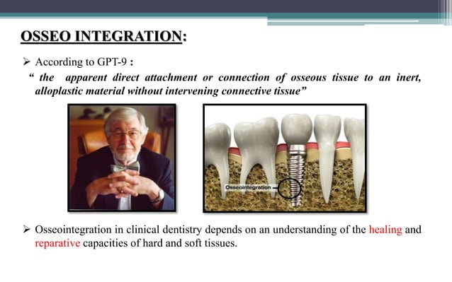 Impact of dental implant surface modifications on Osseo-integration ...