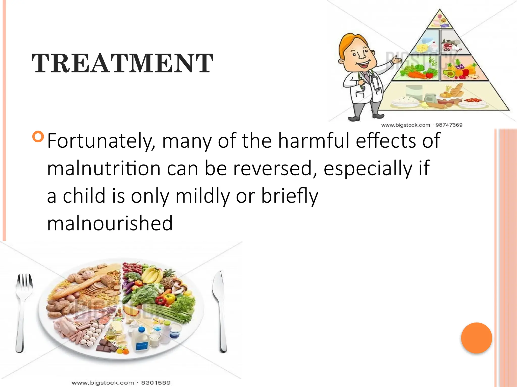Impact of Malnutrition on Health and Development.pptx