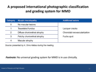 Impact of myopia and high myopia | PPTX