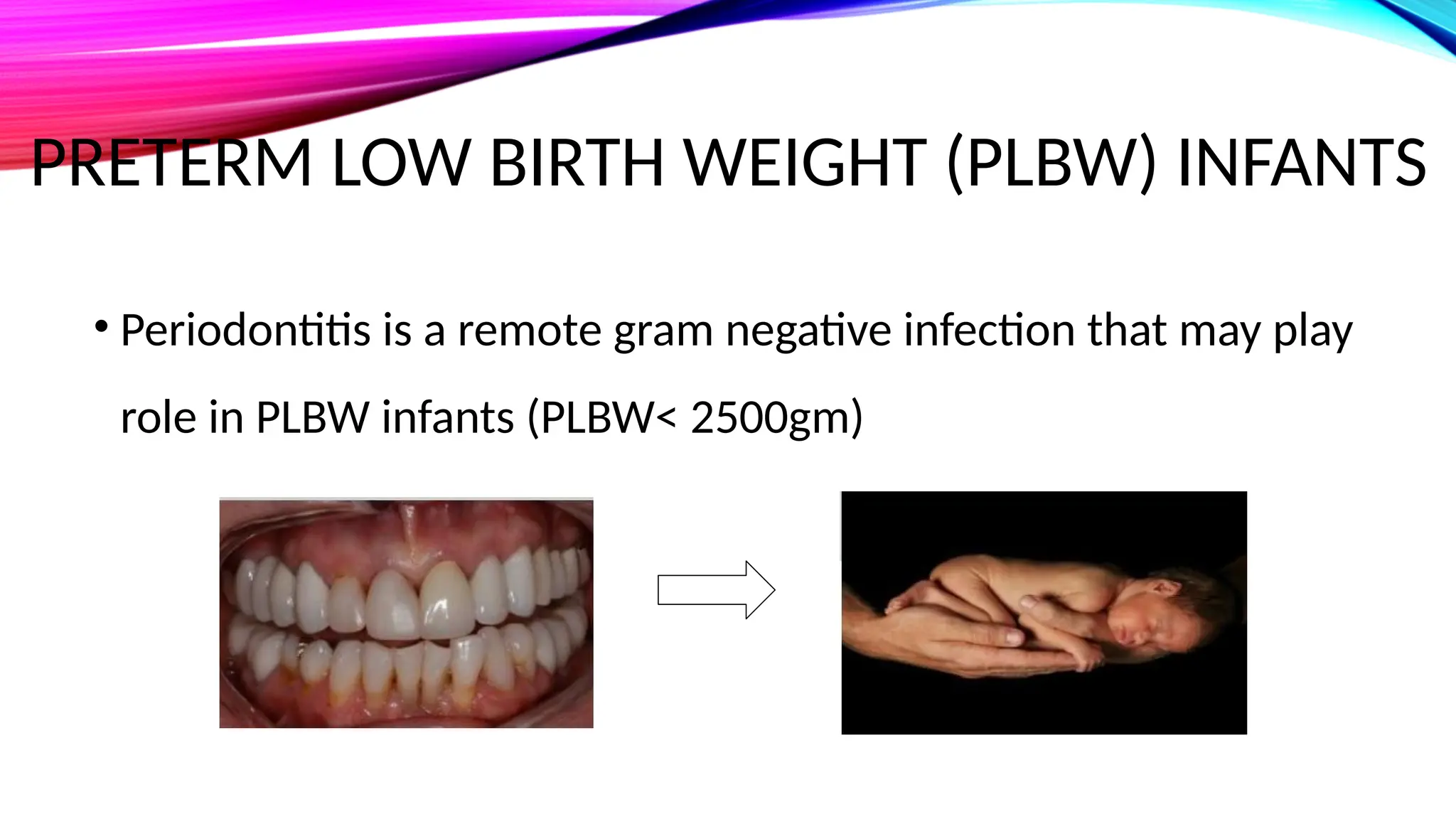 Impact of periodontal infection on pregnancy.pptx