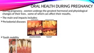 Impact of periodontal infection on pregnancy.pptx