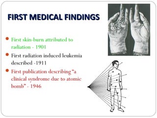 Impact of radiation pollution on human health siri | PPT