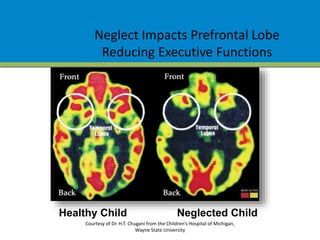 Impact of trauma | PPTX