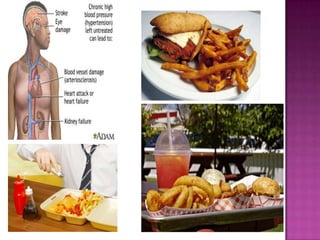 Impacts of fast foods | PPT