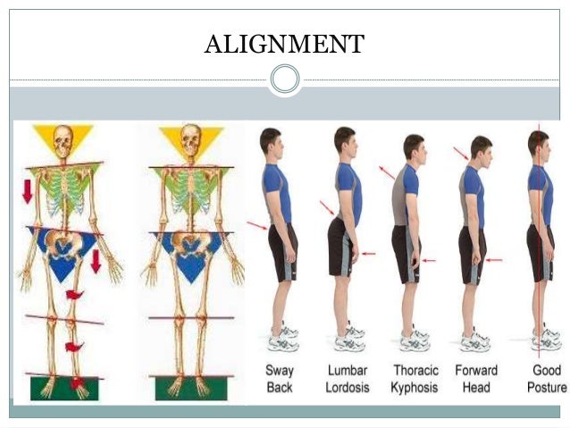 Impair body alignment and mobility & nursing care