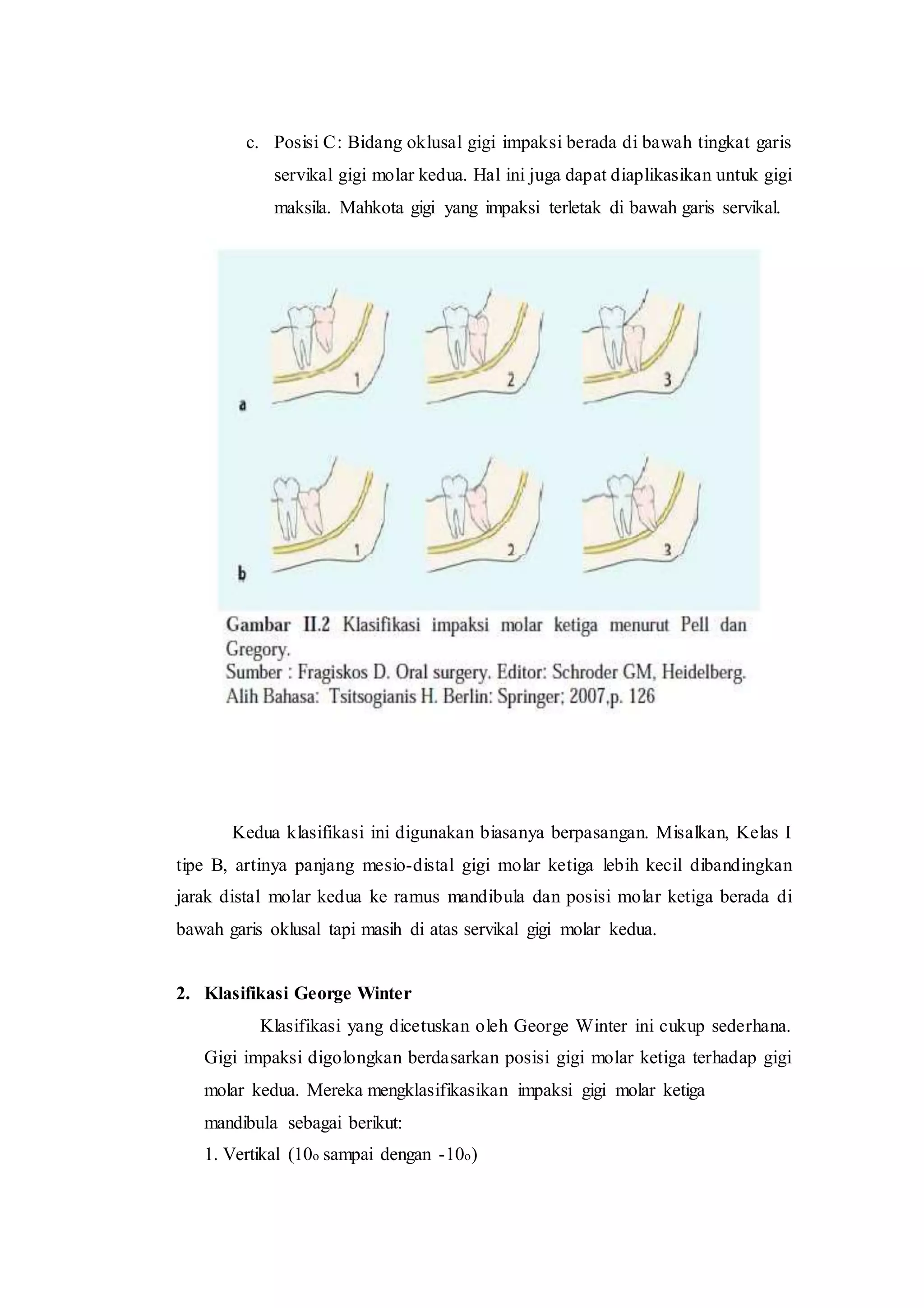 Impaksi maggie | DOCX