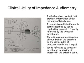 Impedance audiometry | PPTX
