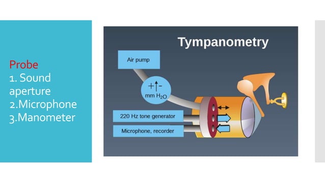 Impedance audiometry.pptx | Ear, Nose and Throat Conditions | Diseases ...
