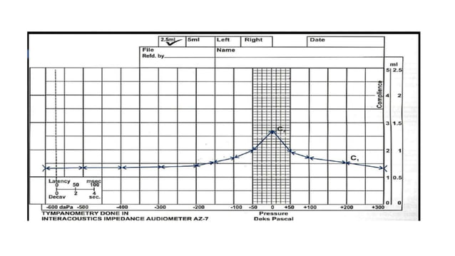 IMPEDANCE AUDIOMETRY.pptx | Ear, Nose and Throat Conditions | Diseases ...