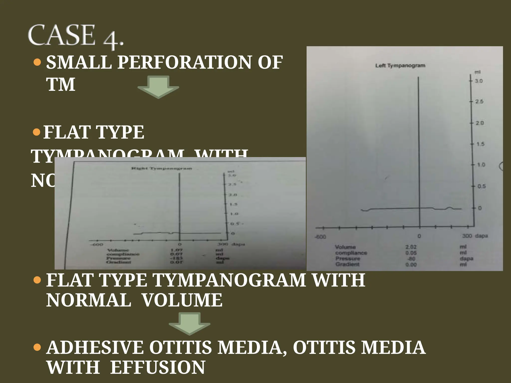 IMPEDANCE AUDIOMETRY in otorhinolaryngology.pptx