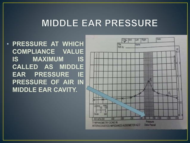 Impedance audiometry part 1 | PPTX | Ear, Nose and Throat Conditions ...