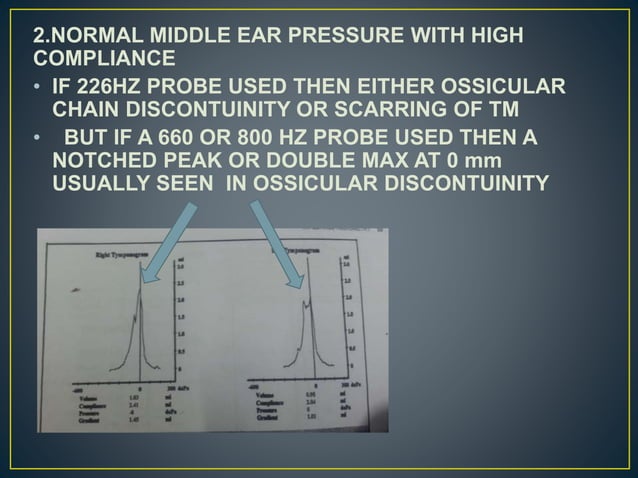 Impedance audiometry part 1 | PPTX | Ear, Nose and Throat Conditions ...