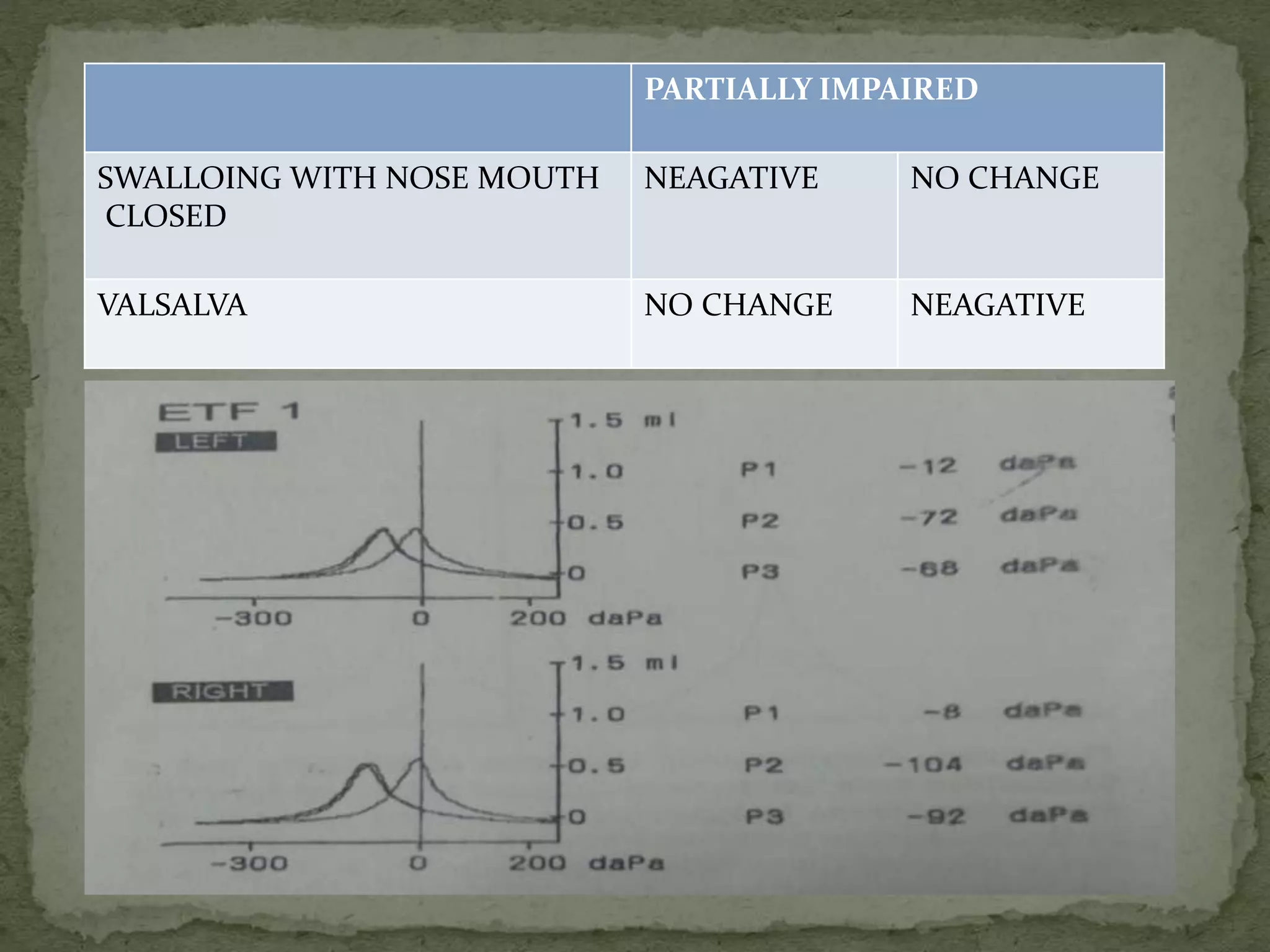 Impedance audiometry part2 | PPT
