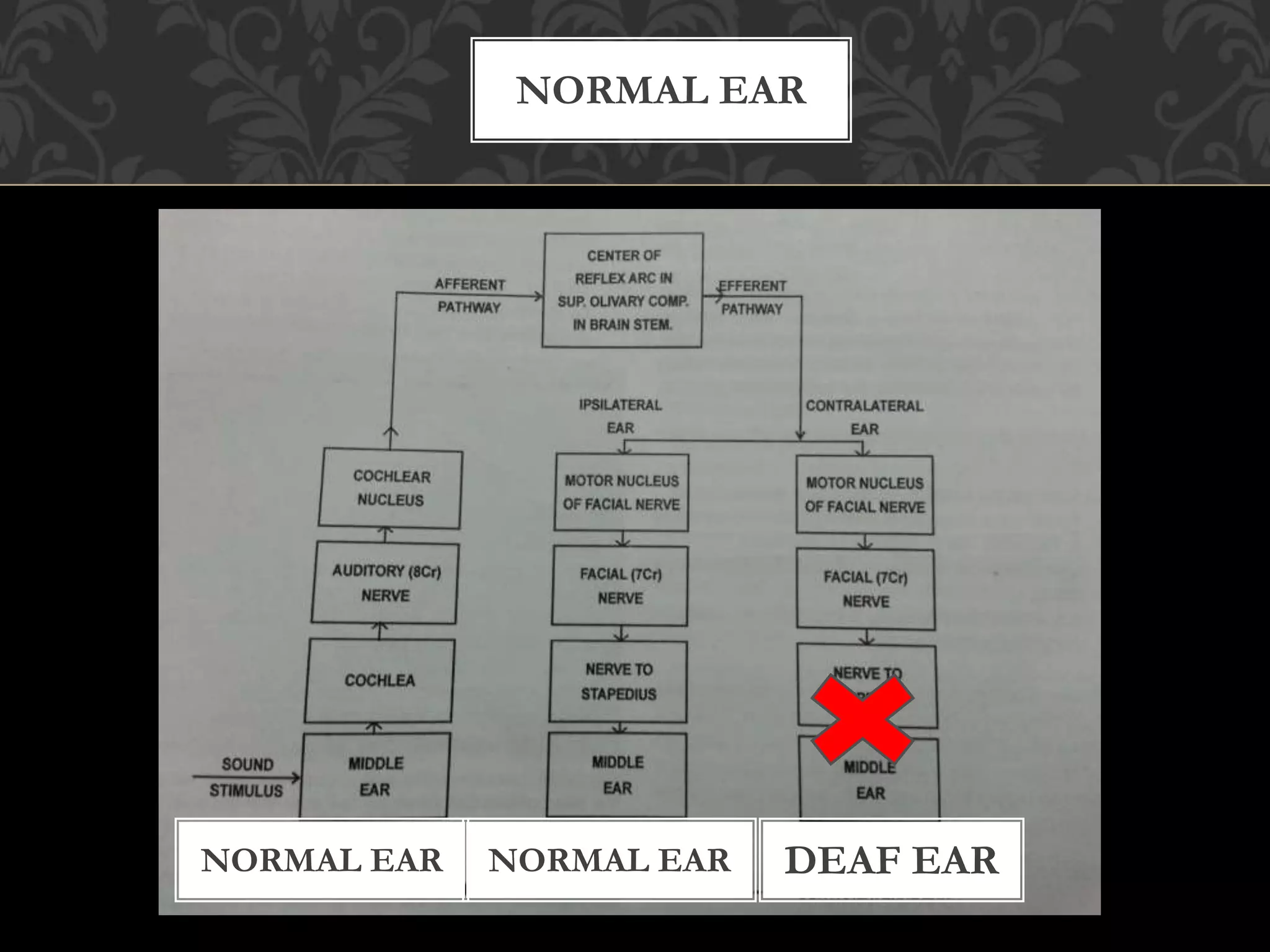 Impedance audiometry part2 | PPT