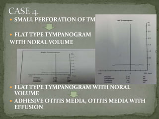 Impedance audiometry part2 | PPT