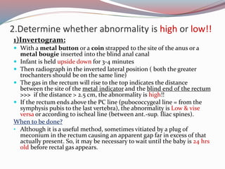 Imperforate Anus | PPTX