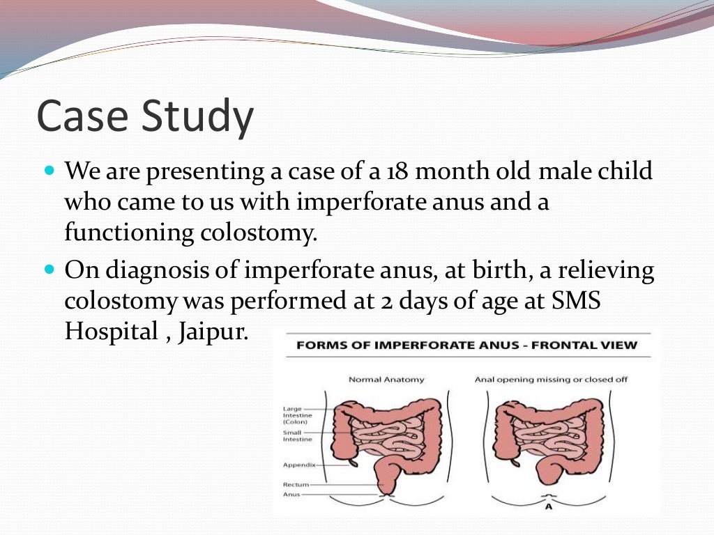 Imperforate Anus