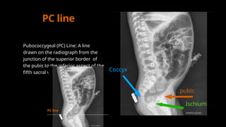 Imperforate anus radiology diagnosis.pptx