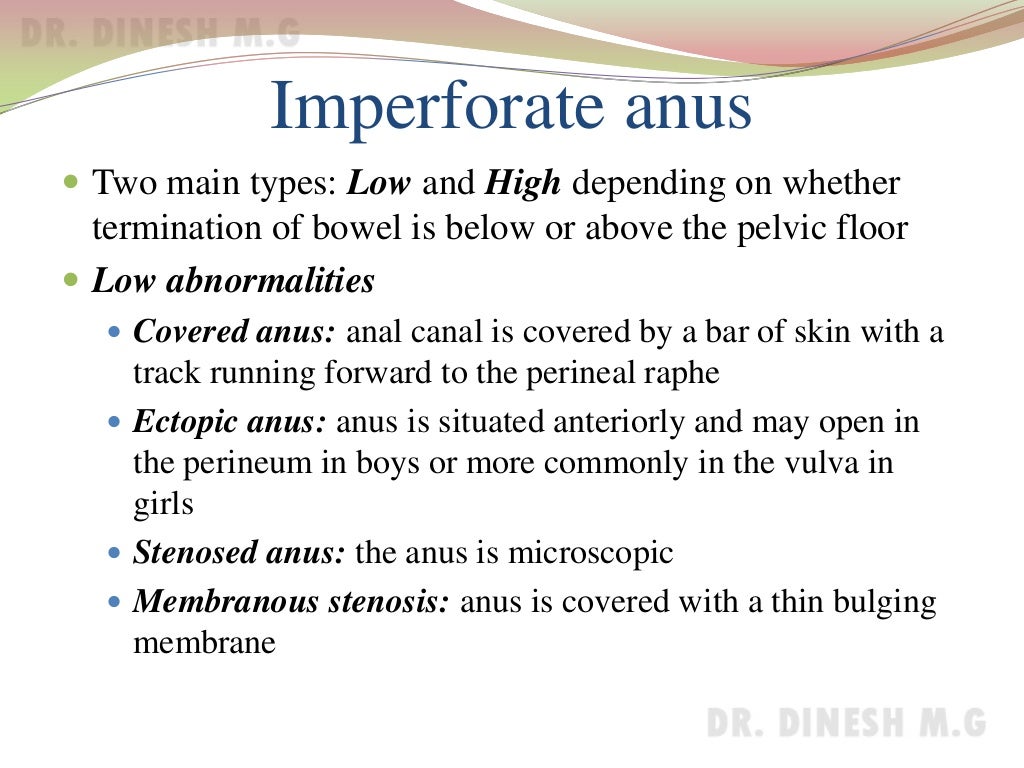 Imperforate Anus