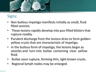 impetigo disease and it's management ppt | PDF