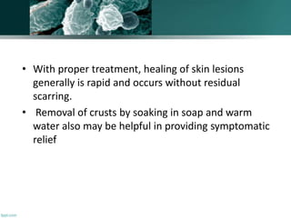 impetigo disease and it's management ppt | PPT
