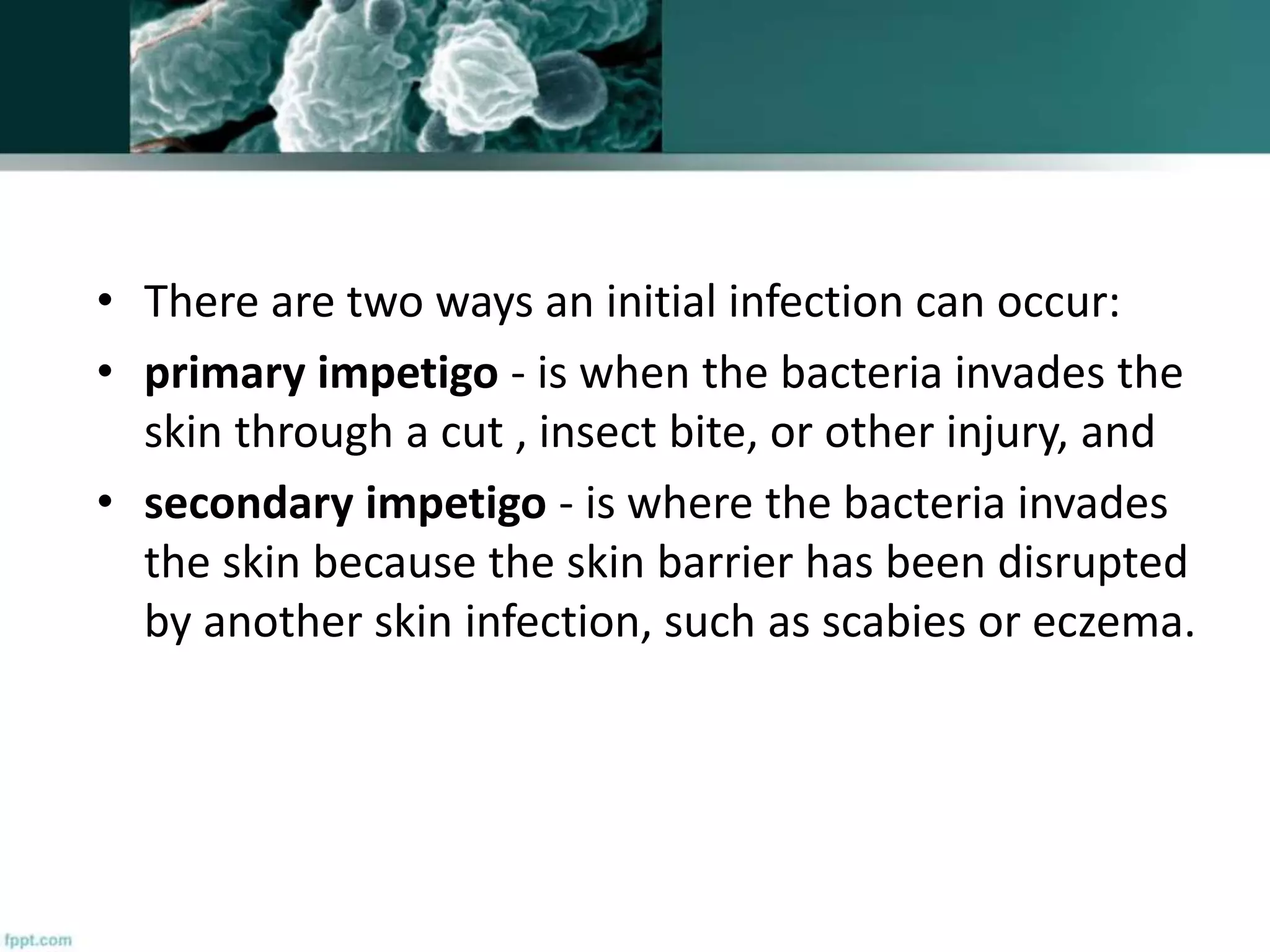 Impetigo | PPTX