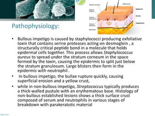 Bullous Impetigo Histology
