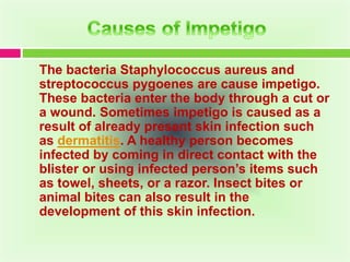 Impetigo | PPTX