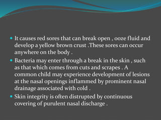 Impetigo | PPTX