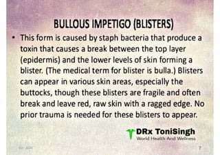 Impetigo | PDF