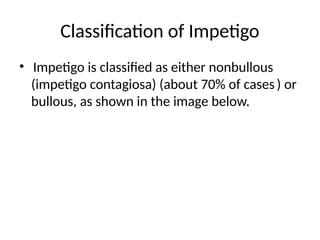 IMPETIGO presentation for nursing student.pptx
